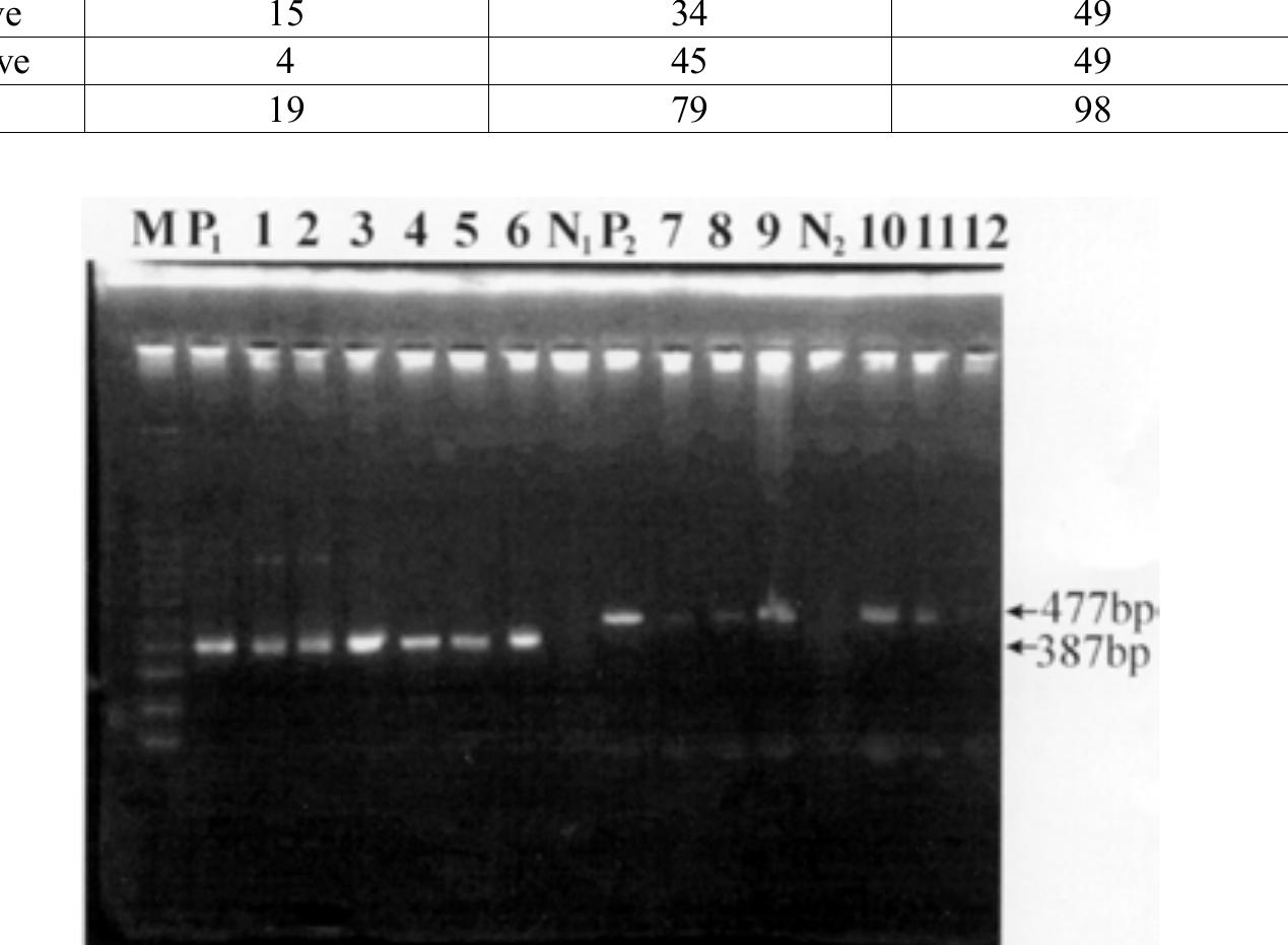 Agarose gel electrophoresis of nested pcr products. m - 100