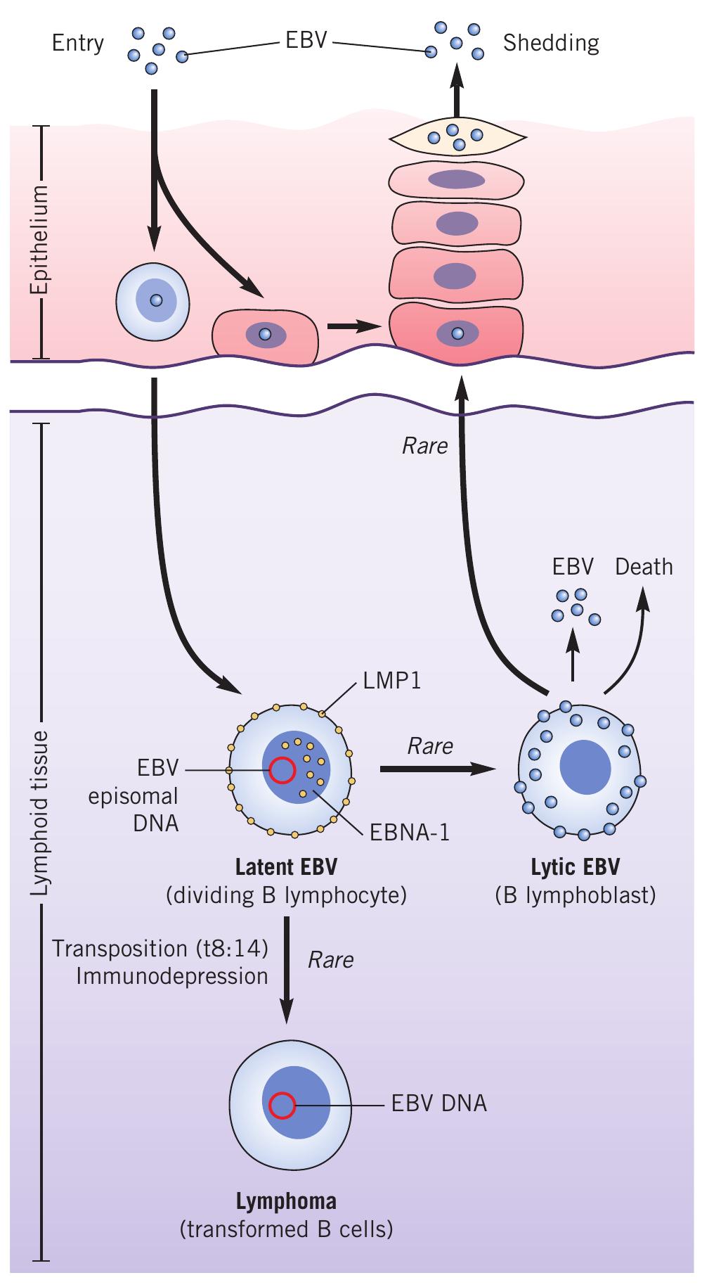 8 diagrammatic summary of possible pathogenesis of ebv and