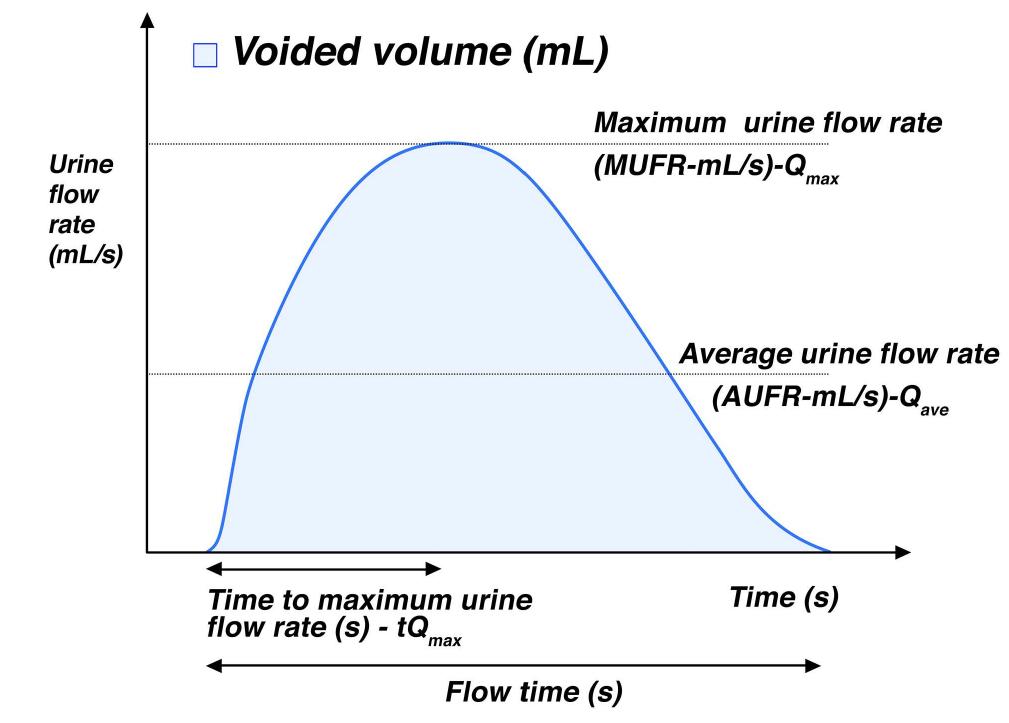 A schematic representation of urine flow over time and