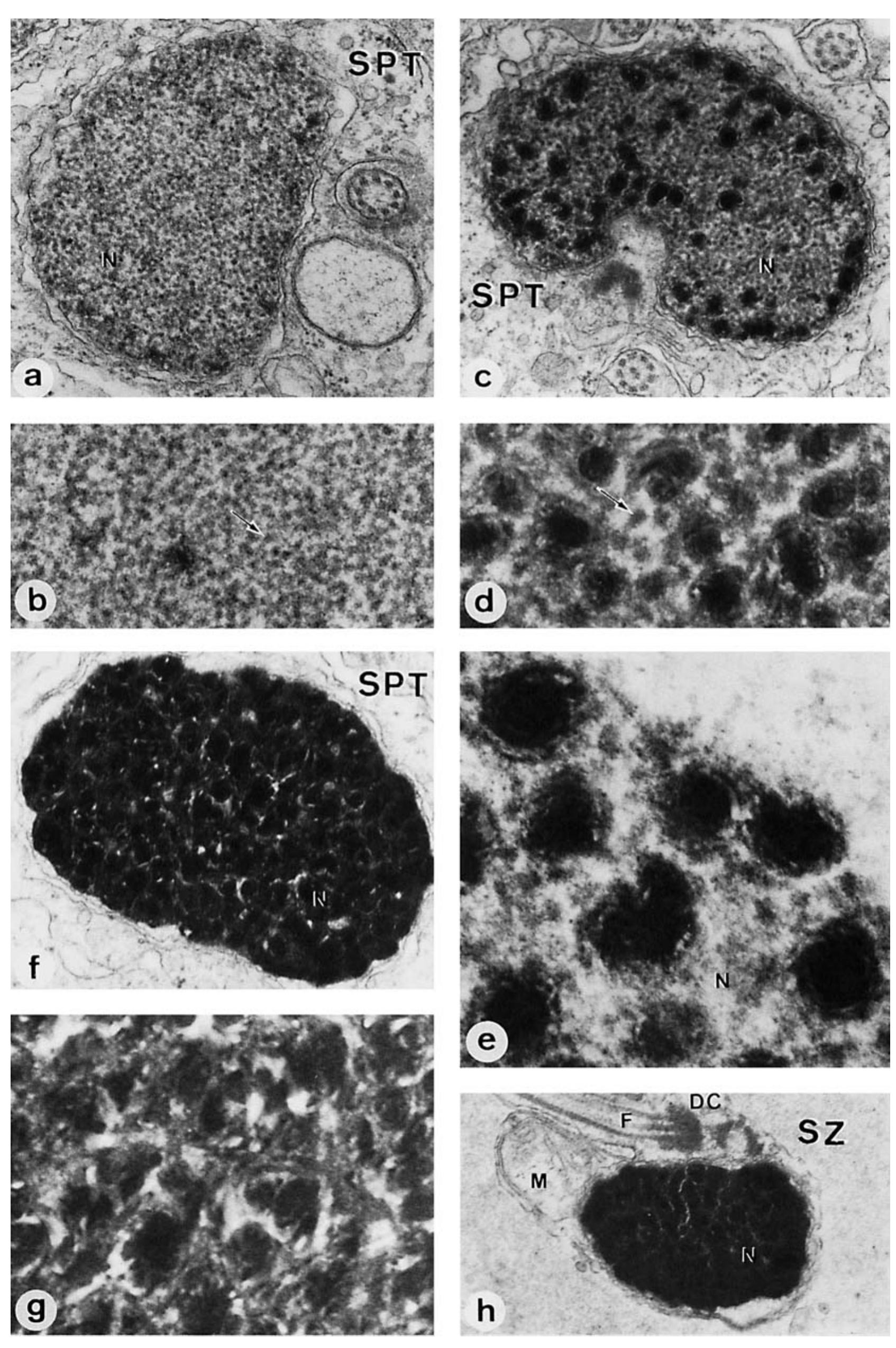 Patterns of chromatin condensation during d. labrax