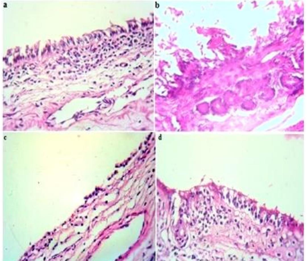 Histopathalogical images of goat nasal mucosa a. pbs