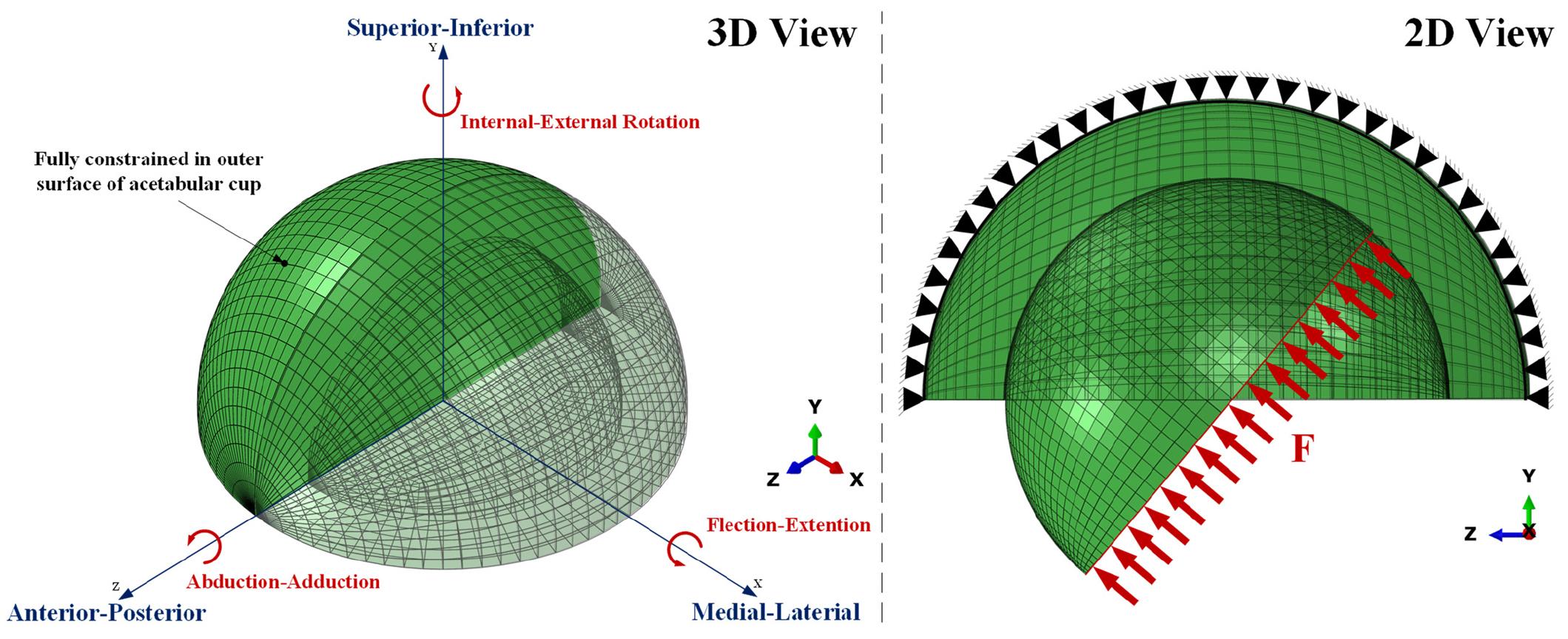 Finite element contact model of the femoral head and