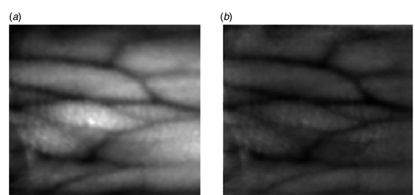 A Nir Image Of The Wrist And 5 Image After Processing