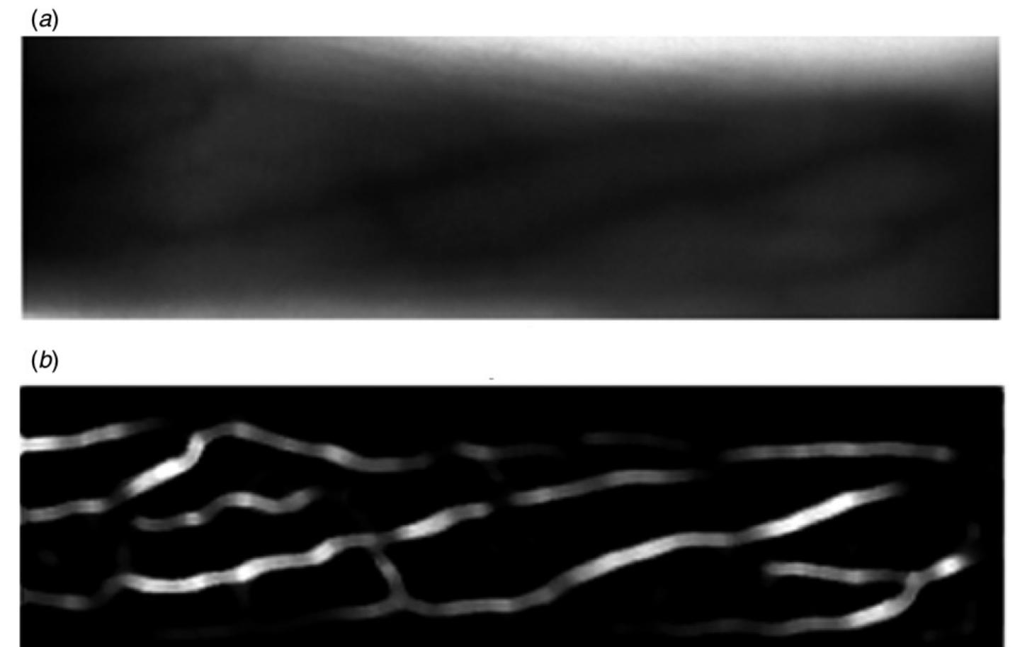 (a) nir image of the finger, and (4) vein pattern