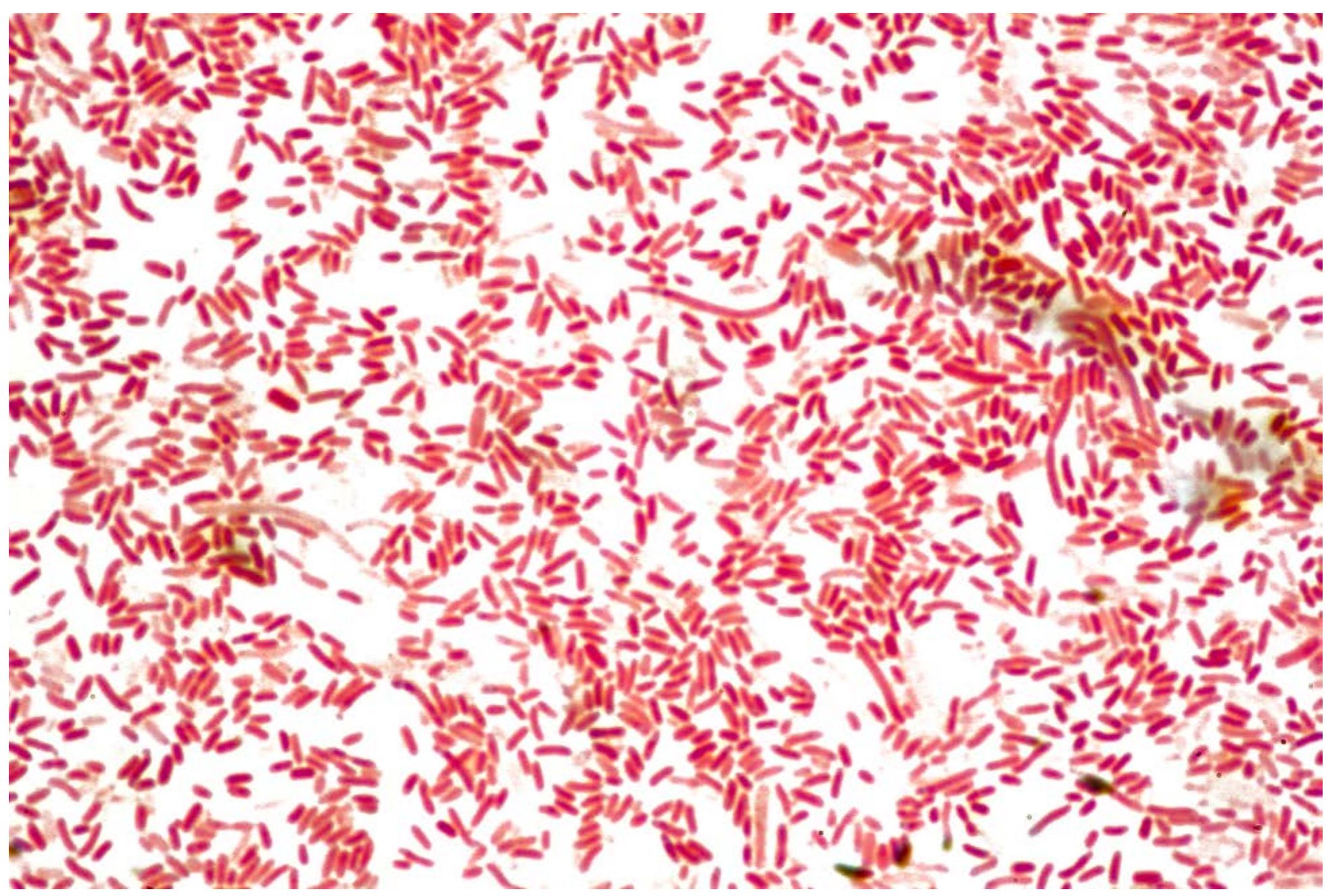 Illustration 22: gram staining, fe. coli (dh5-alpha). photo: