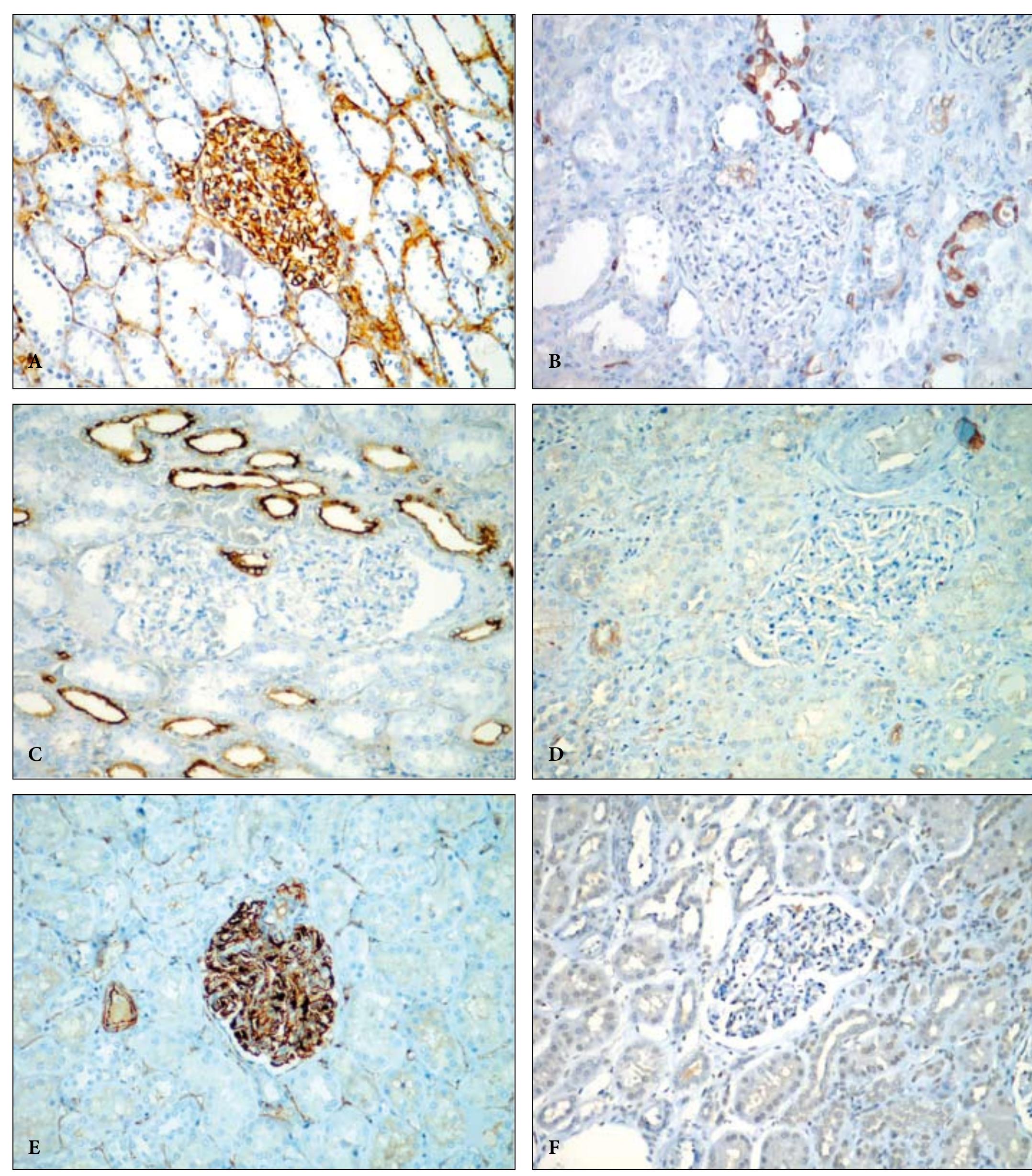 Glomerular and tubular structures with different