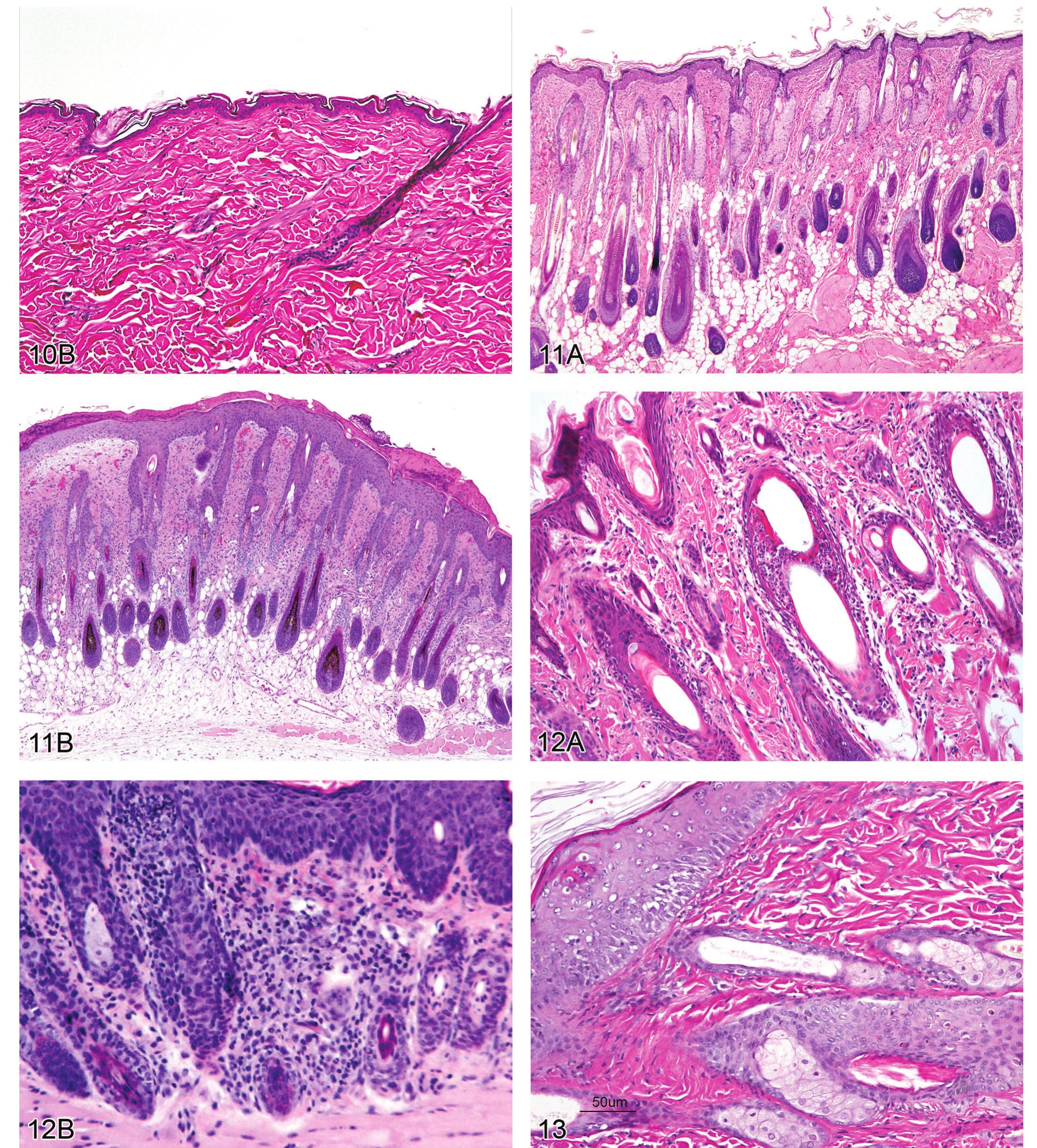 Figure 3 - Proliferative and Non-Proliferative Lesions of