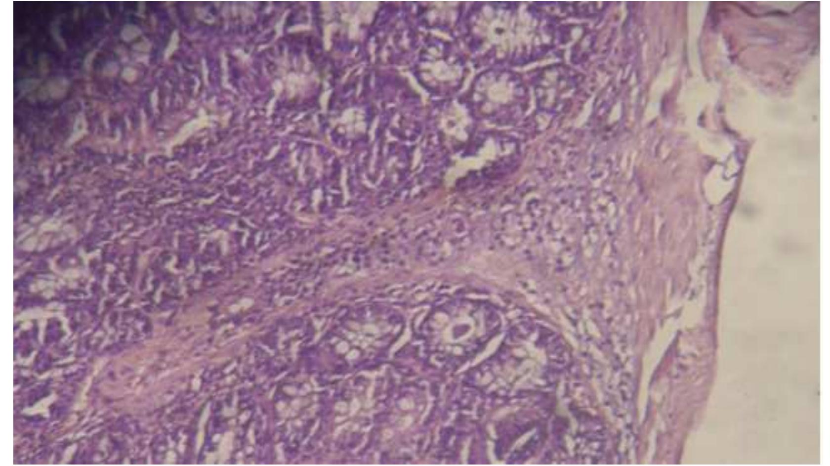 Retune the intestinal tissue to normal structure after