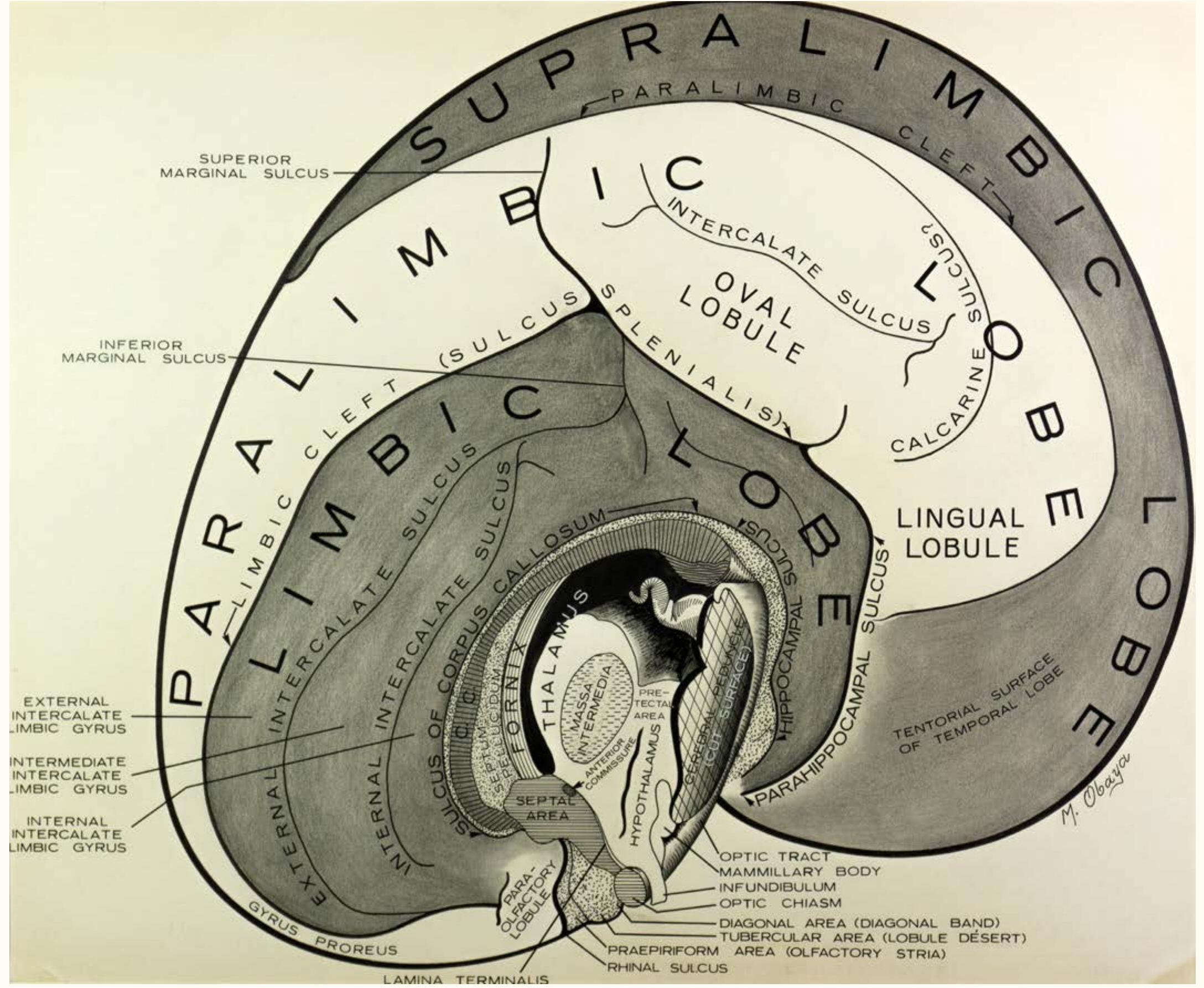 Interpretive drawing of the medial wall of the right