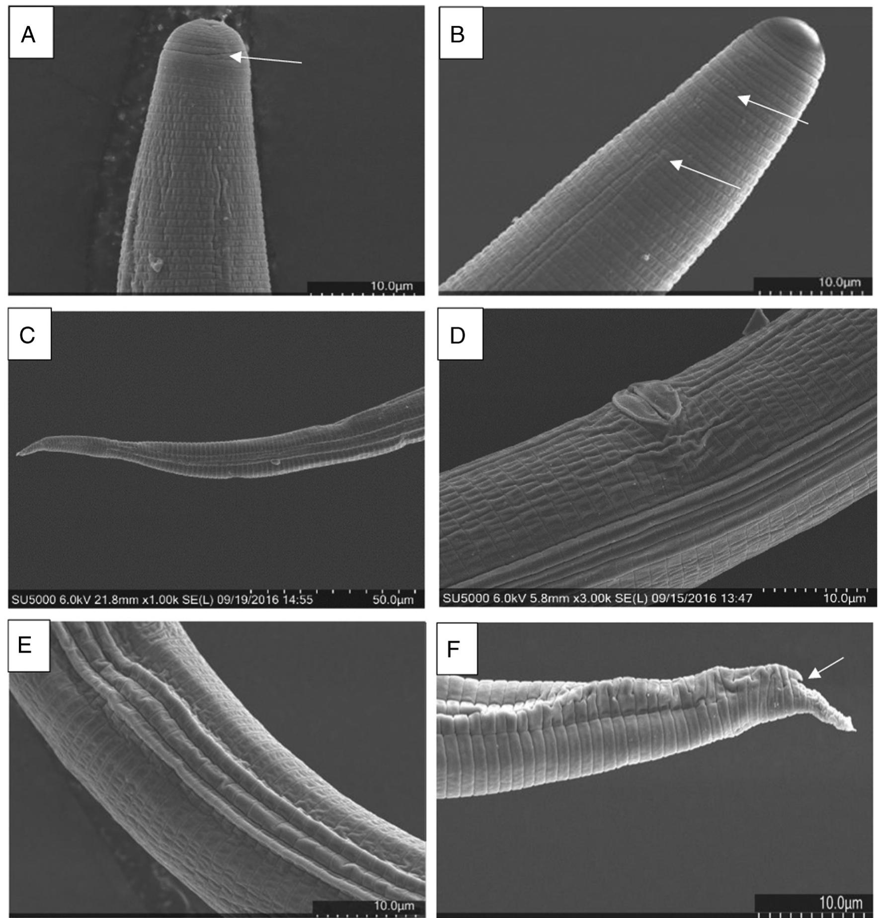 Hirschmanniella dicksoni n. sp. female: (a) anterior region;