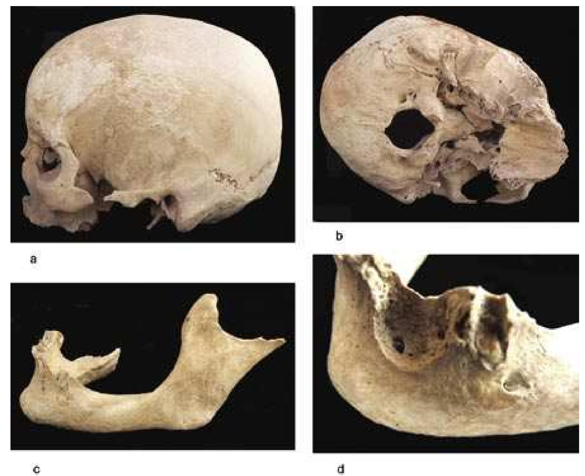 9. zin13.171. a)—b) cranium and c)—d) mandible of an
