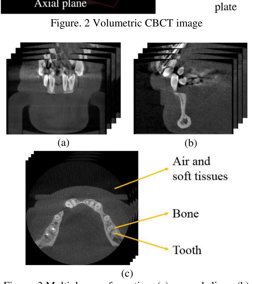 Figure 3 - Automatic Segmentation of Mandibular Cortical