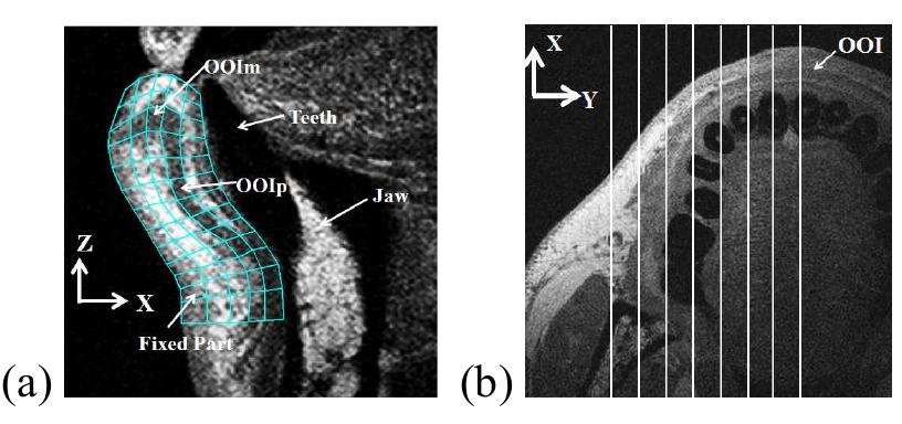 High-resolution lip mri. (a) midsagittal mri slice (xz plane