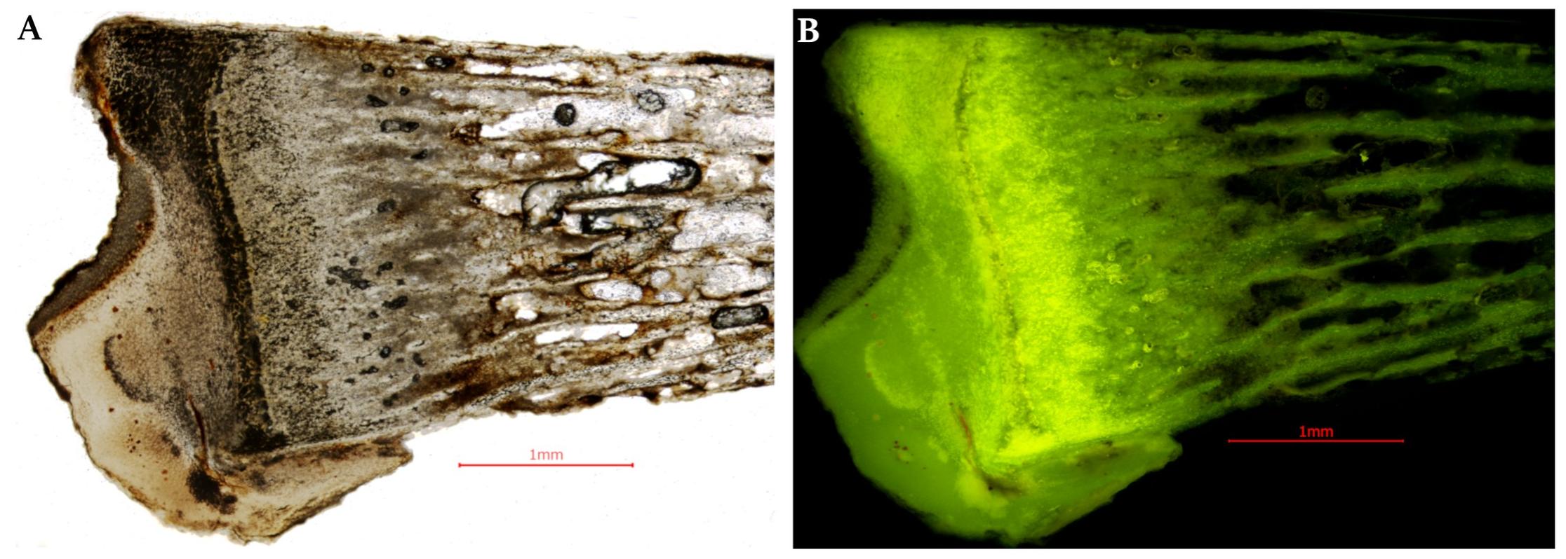Sagittal section of the tibia-proximal epiphysis.