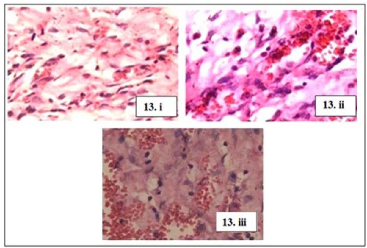 Histopathology of regenerated tissue of open wounds i. group