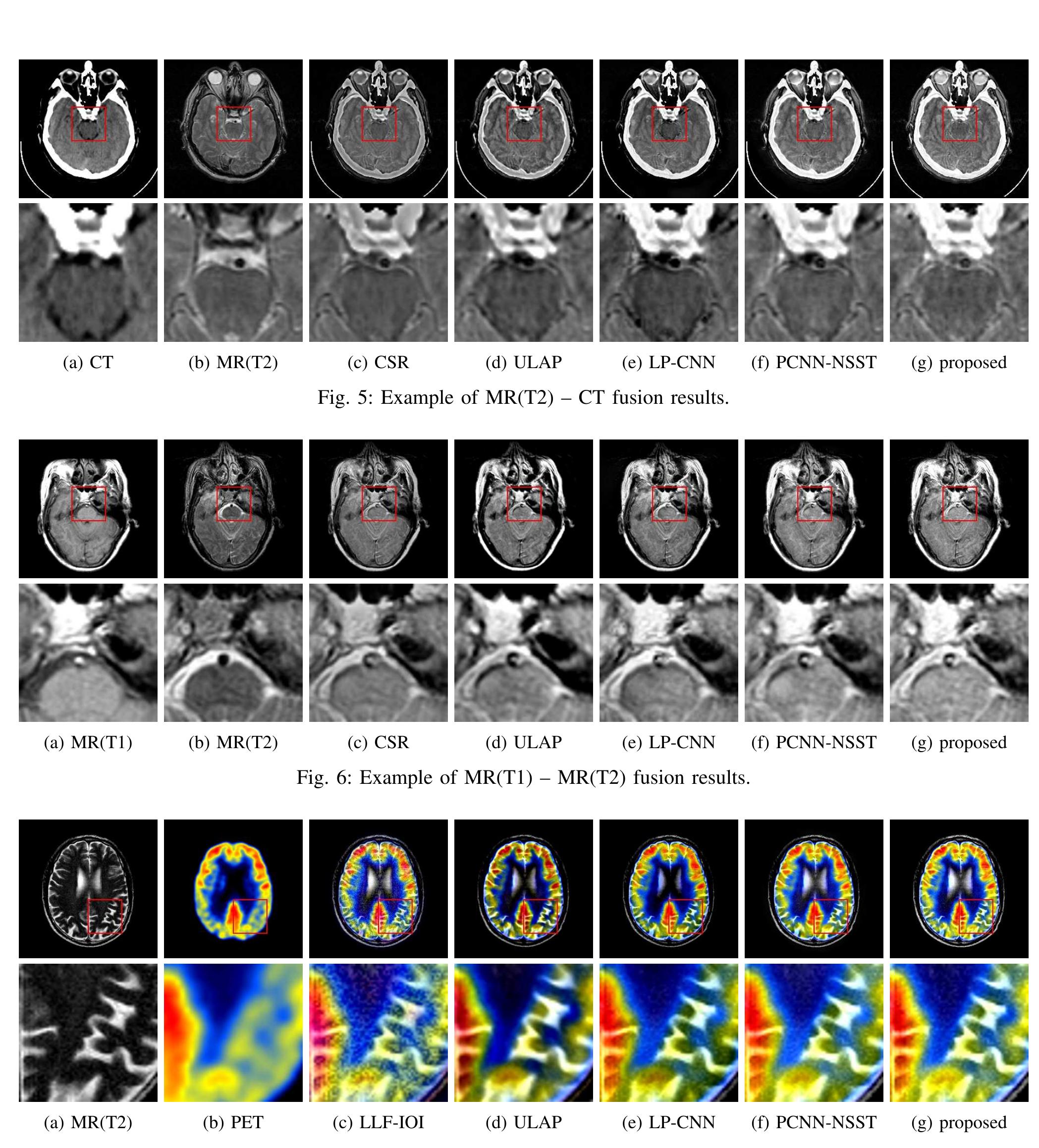 Figure 8 Coupled Feature Learning For Multimodal Medical