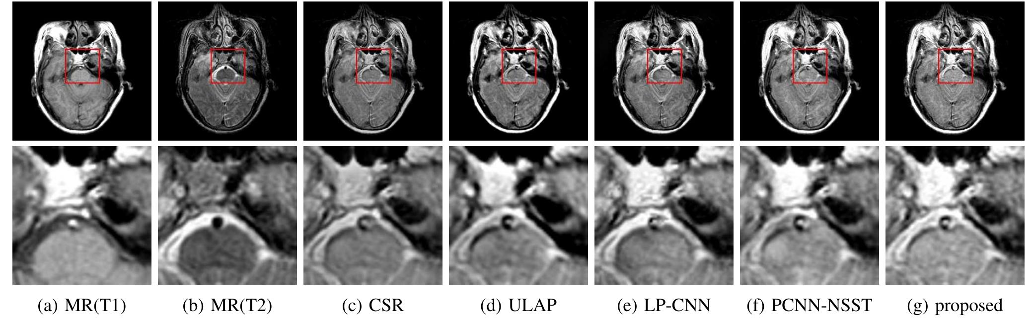 Example of mr(t1) — mr(t2) fusion results. fig. 5: example