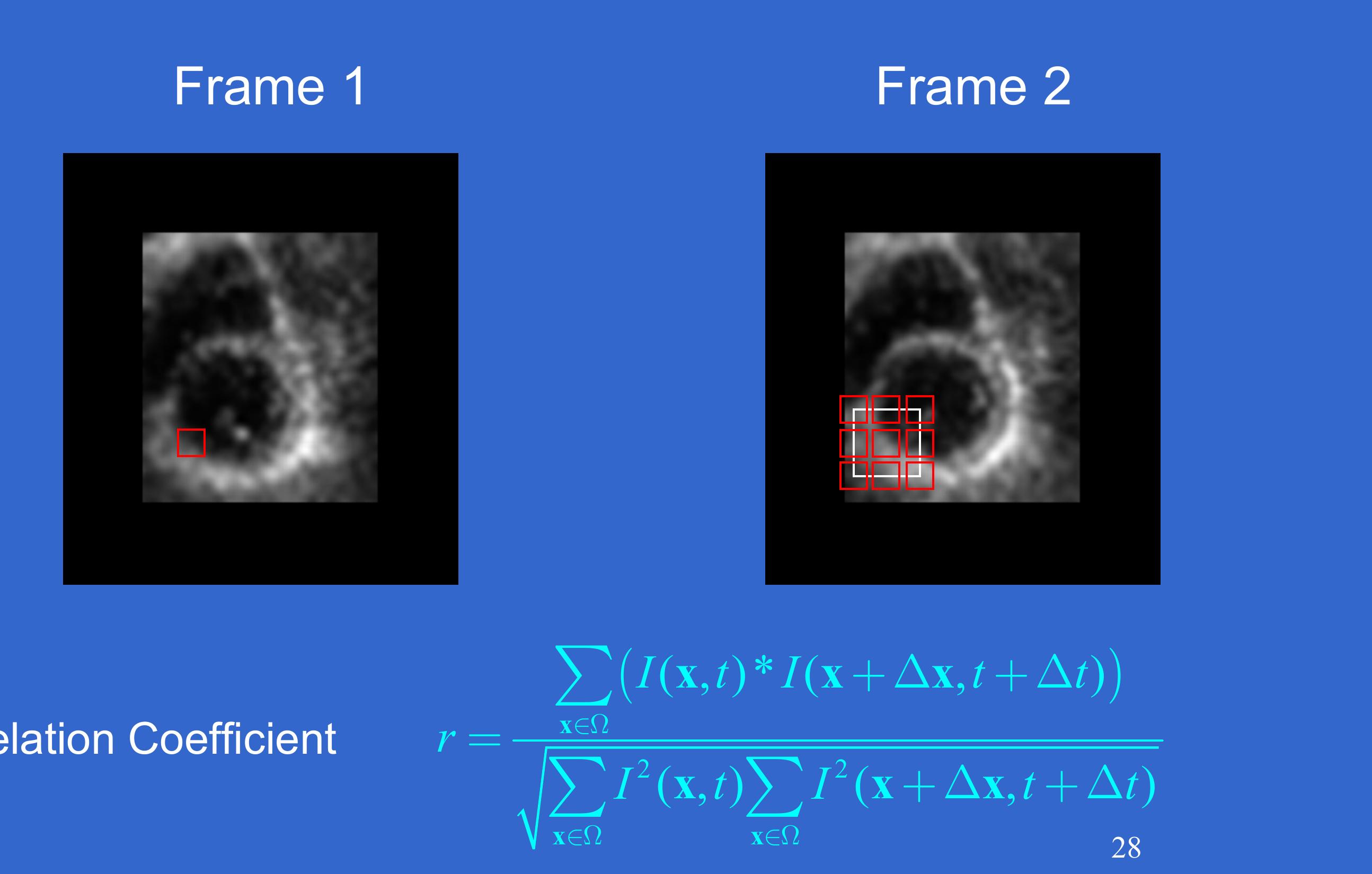 Figure 11 - Dynamic Cardiac Information From Optical Flow