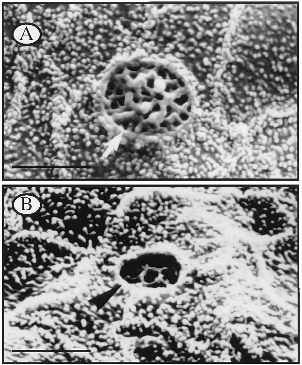 Representative scanning electron microscope photo- graphs of