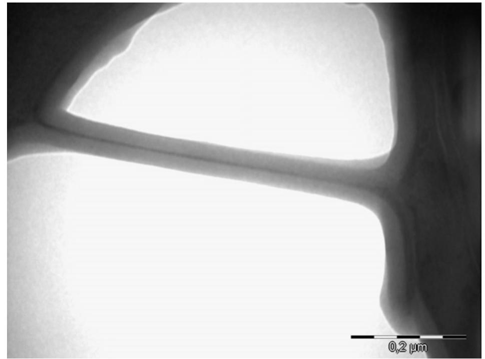Tem micrograph of o-keratin intermediate filament from a