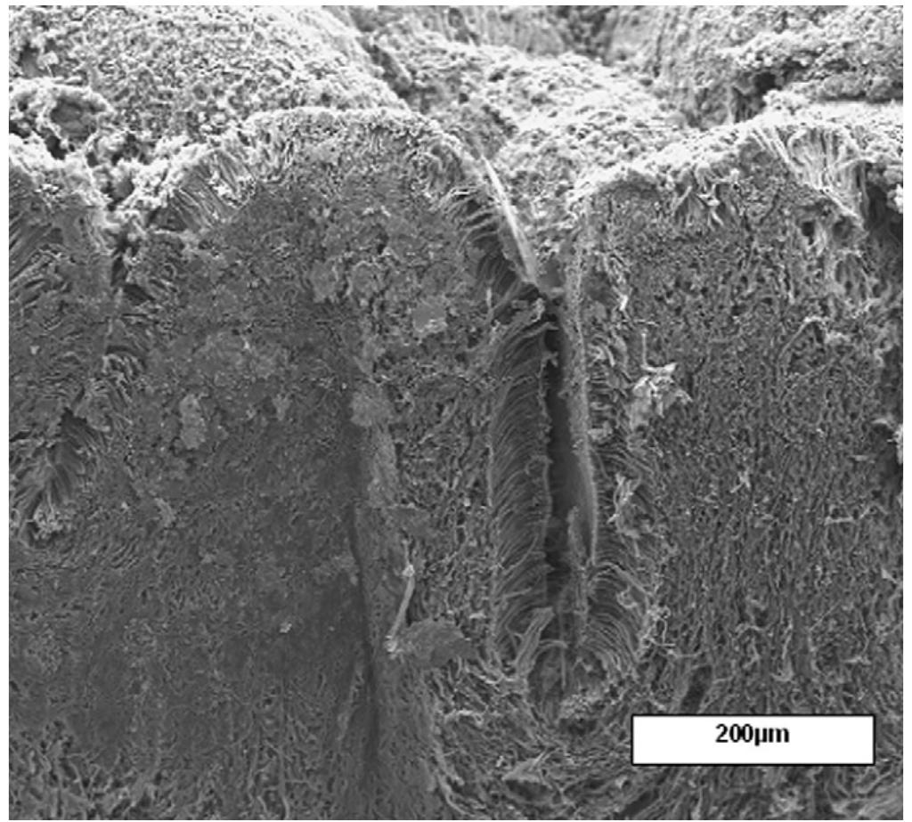 Scanning electron microscopy of foot tissue of abalone