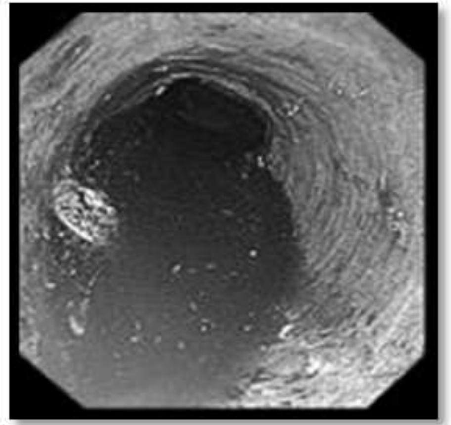 F igure4., presence of bilious stomach material in the