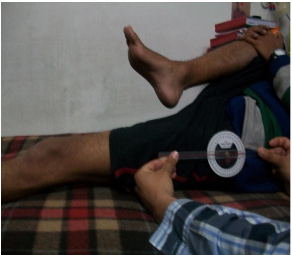 Goniometric measurement of the lliopsoas muscle length