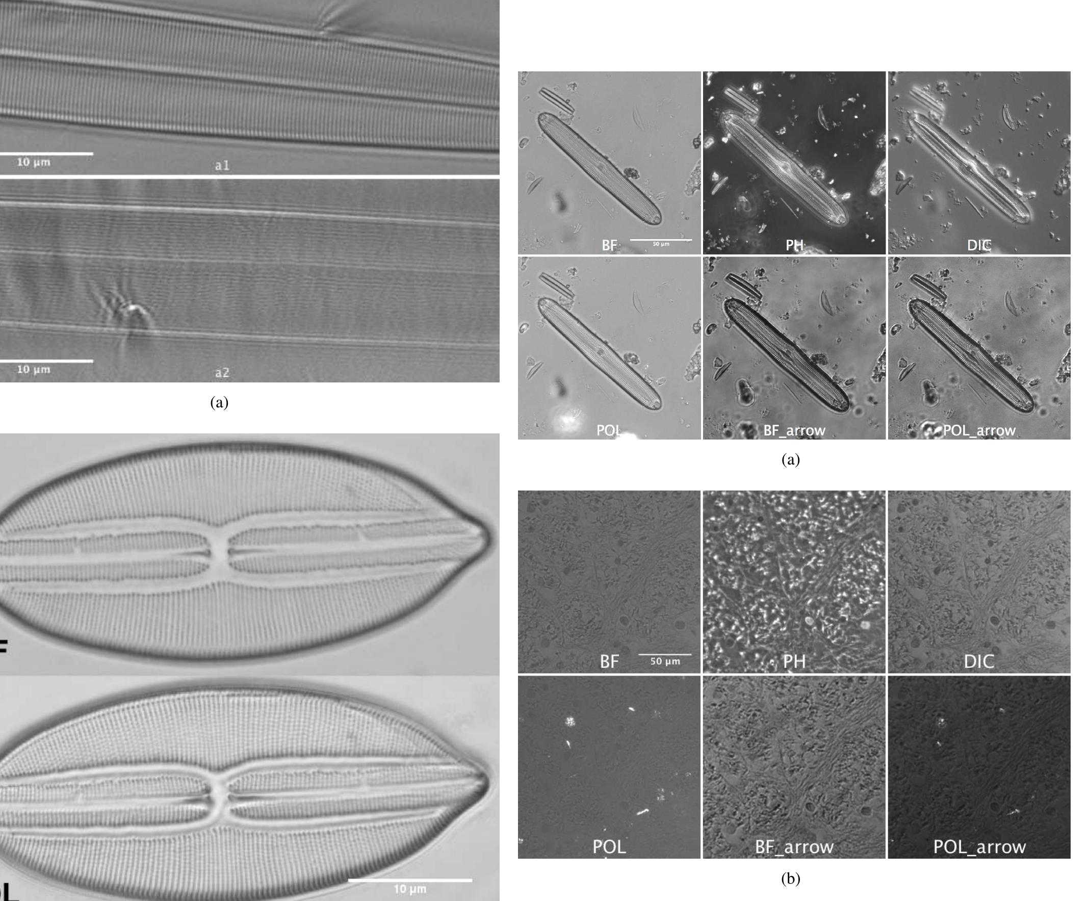 (a)pinnularia neomajor diatom visualized using the following