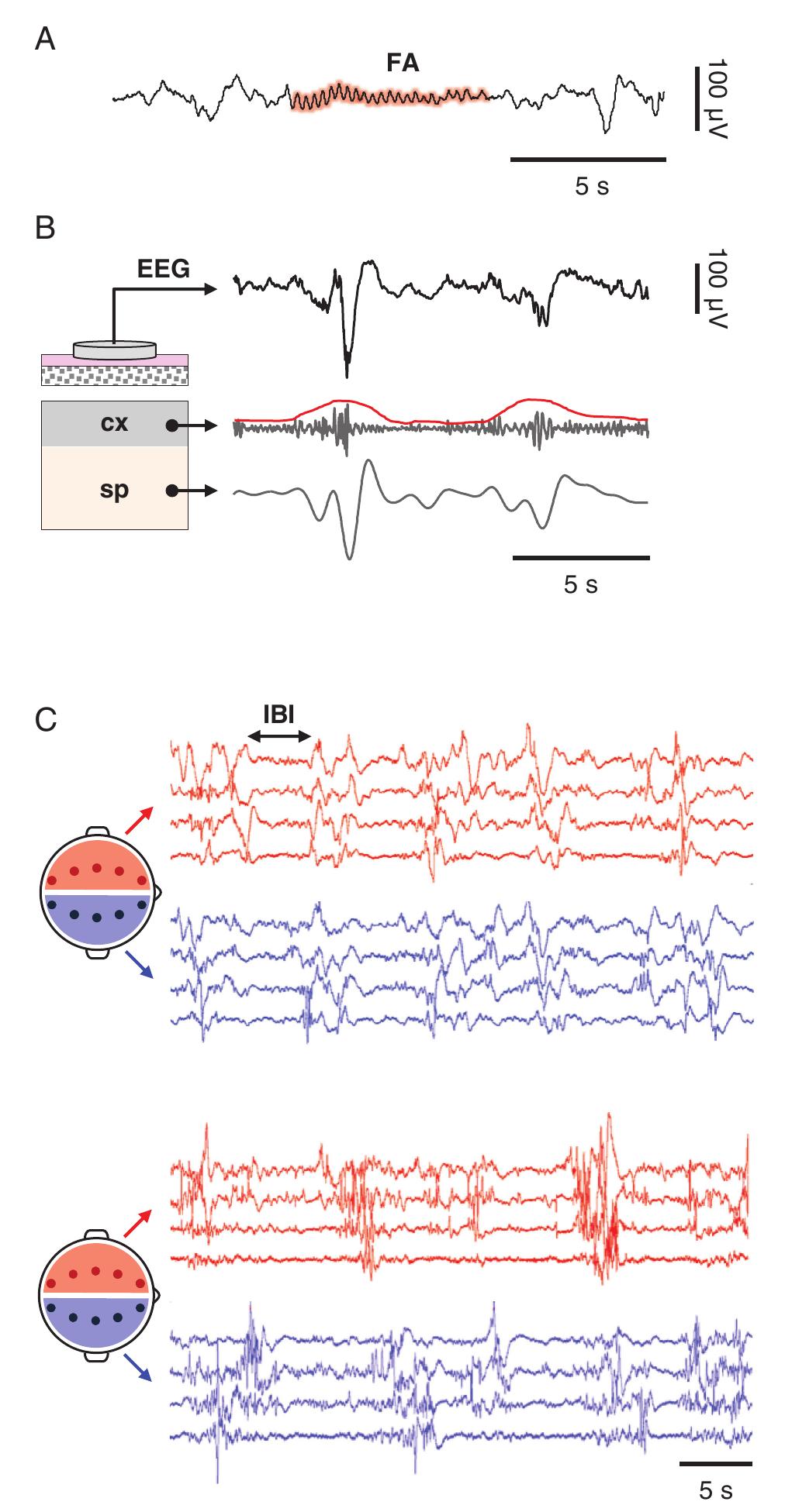 Schematic illustrations of the eeg measures. (a) frontal