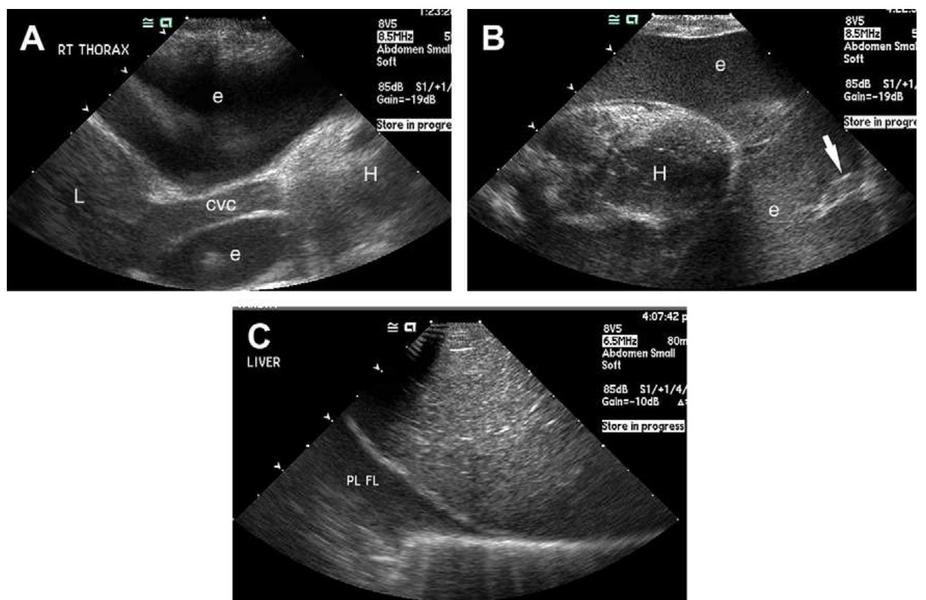 (a) longitudinal ultrasound scan of the caudal thorax in a