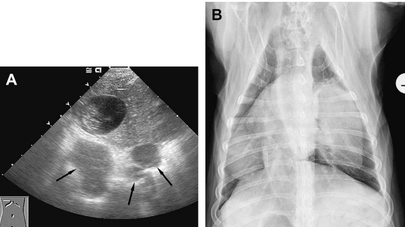 Figure 14 - from Ultrasound of the Thorax (Noncardiac)