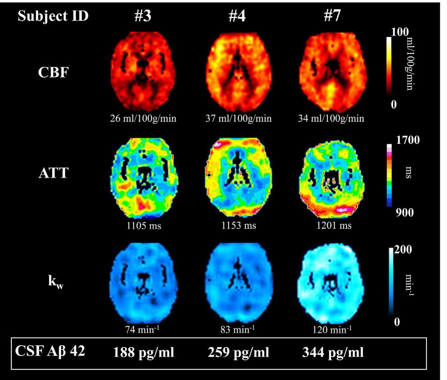 schematic representation of findings. maps of cerebral