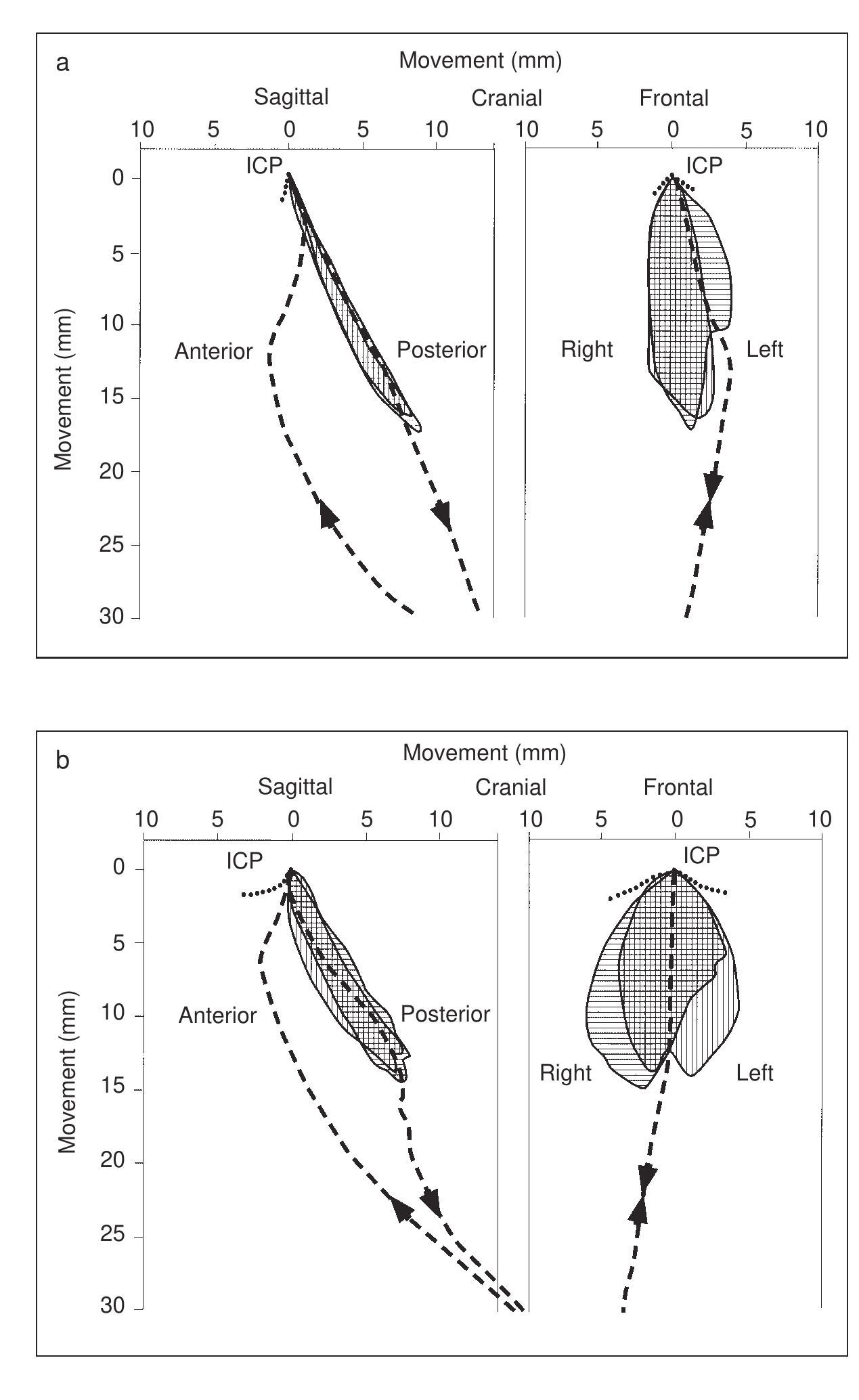 Figure 8 - The Role of the Human Lateral Pterygoid Muscle in