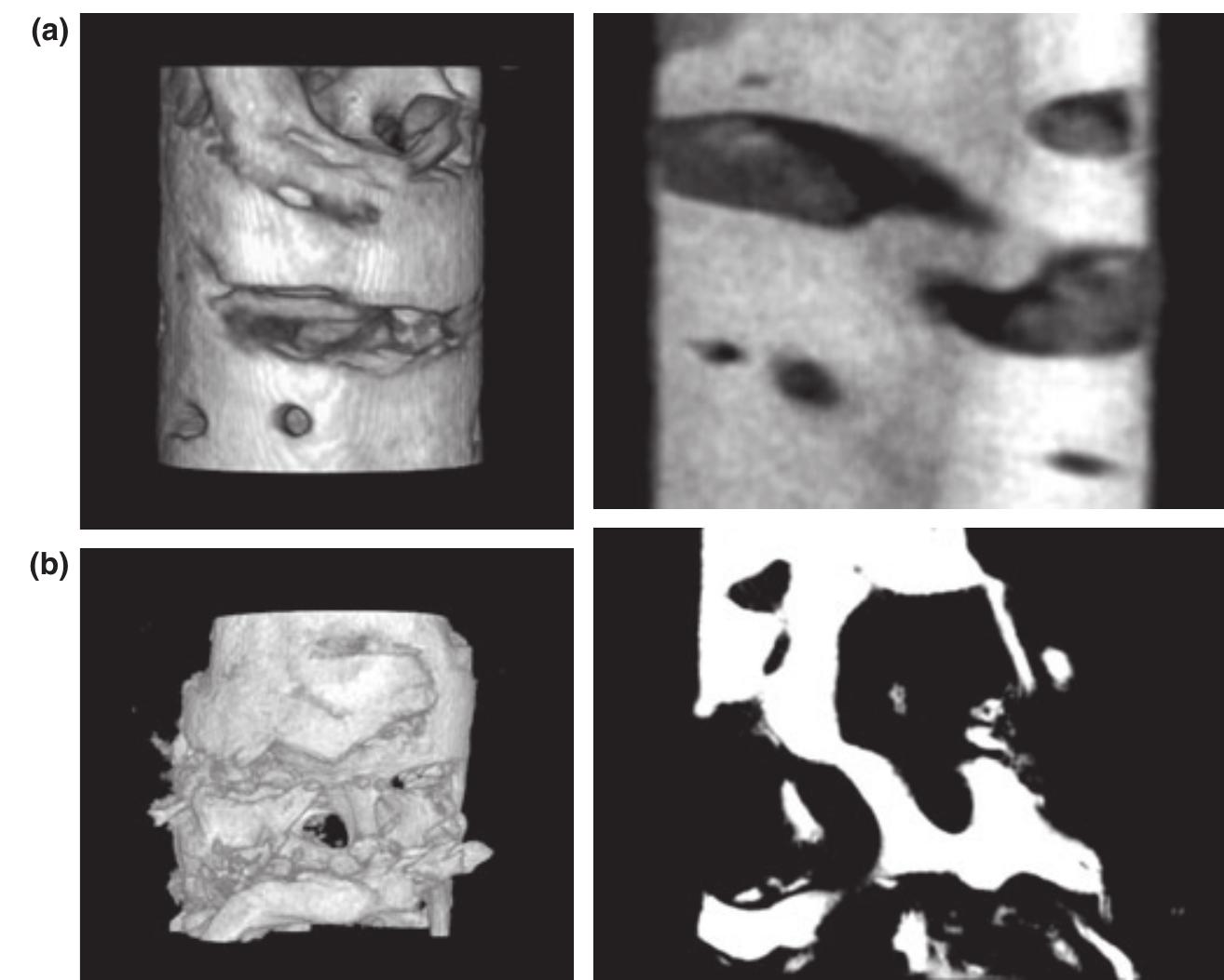 Mandibular bone. anterior (a) and posterior (b) mandibular