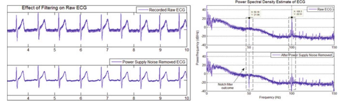 12 effect of notch filtering on ecg signals (time domain on