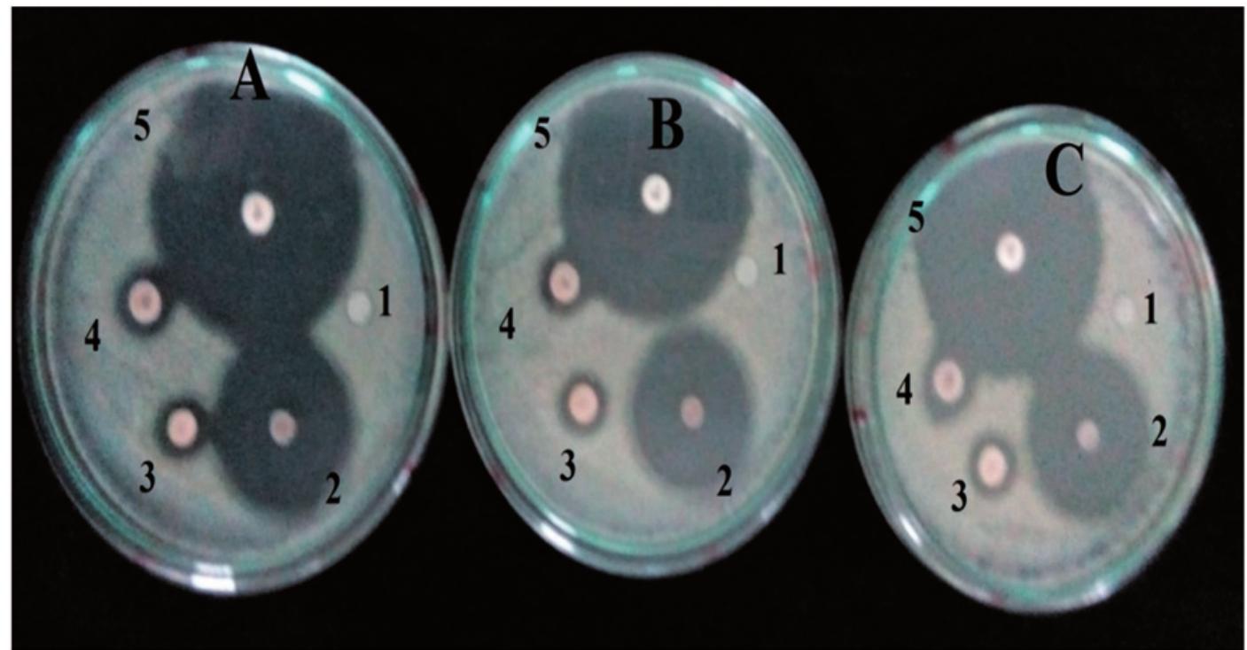 Diagram showing disc diffusion method (a) e. coli, (b) b.