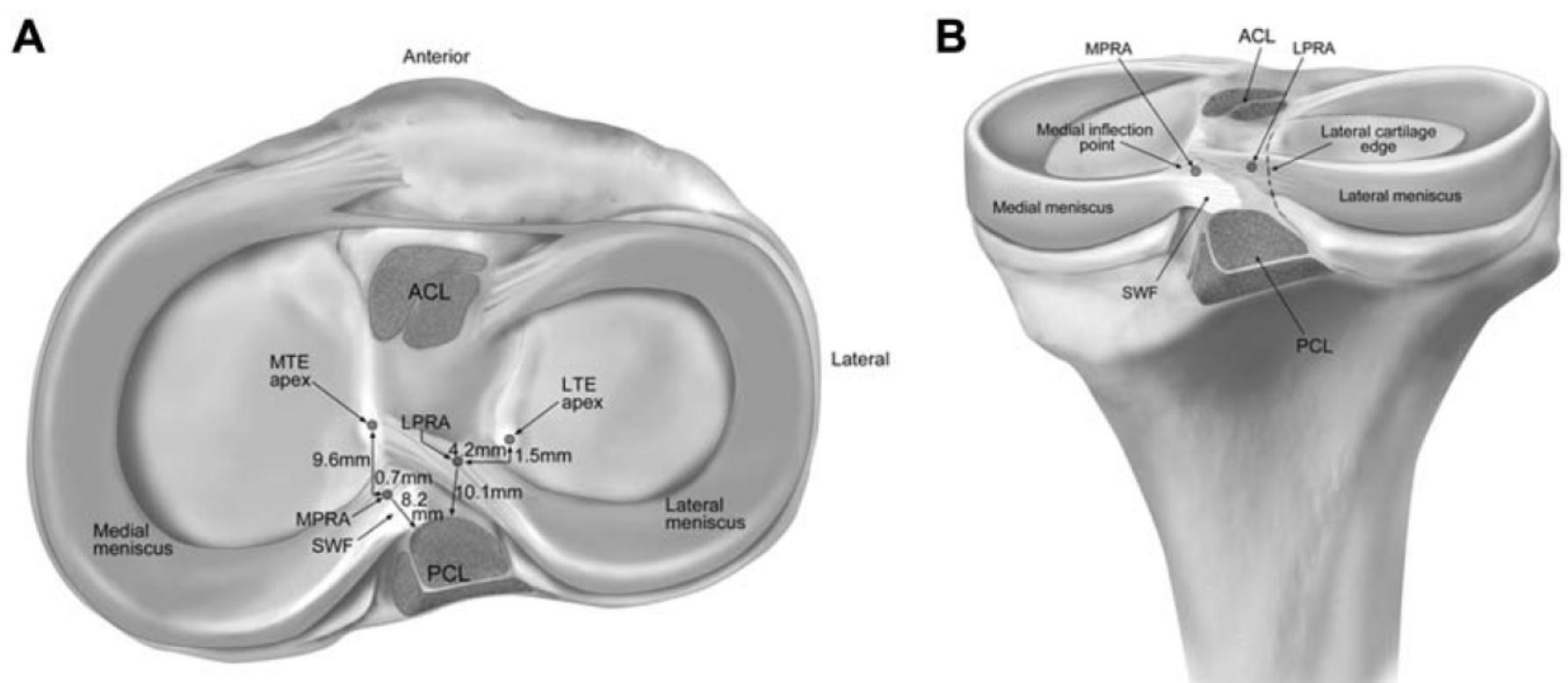 Medial and lateral meniscal posterior root attachments and
