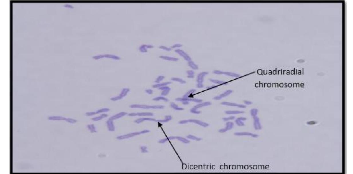 A: human chromosomes, male sample (1000 x, giemsa stain)