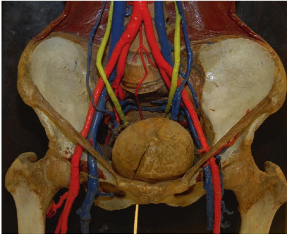 3 anatomy of major pelvic vasculature. note: the venous sys-