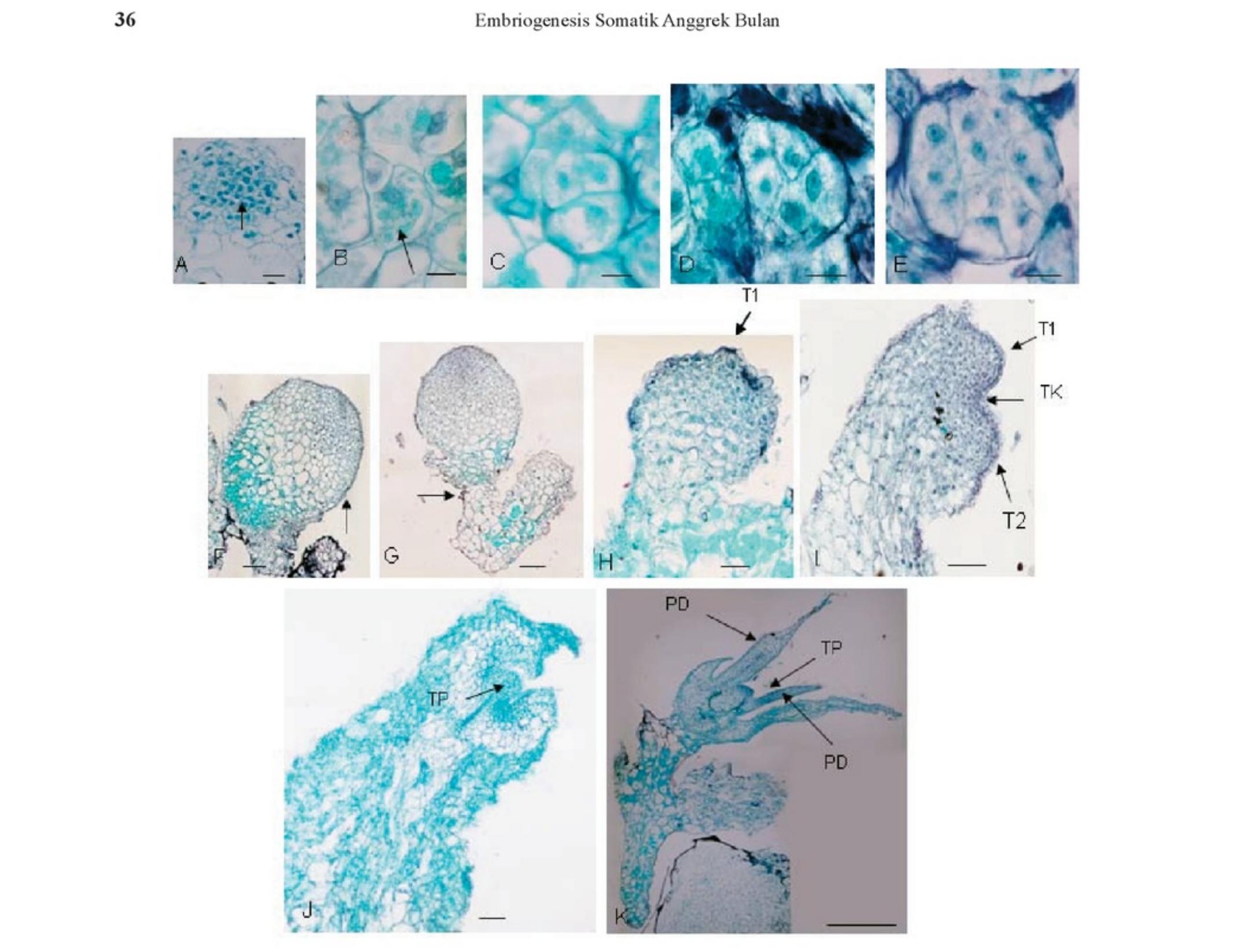 Gambar 2. gambaran histologis perkembangan embrio somatik ph