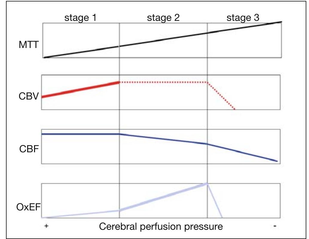 Figure 7 - from Brain perfusion CT: principles, technique