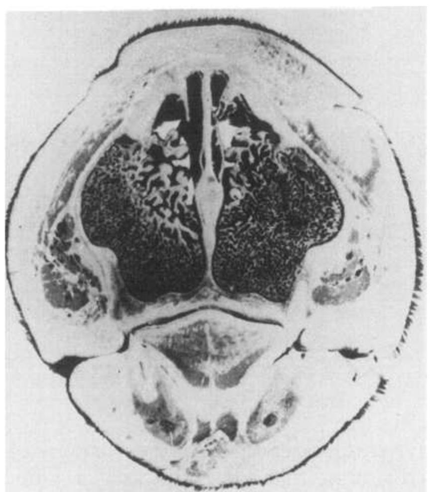 Coronal section of the nasal cavity of a seal demonstrating