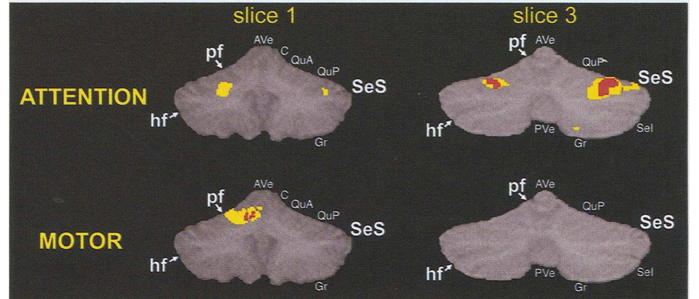 Functional maps demonstrating the most common sites of