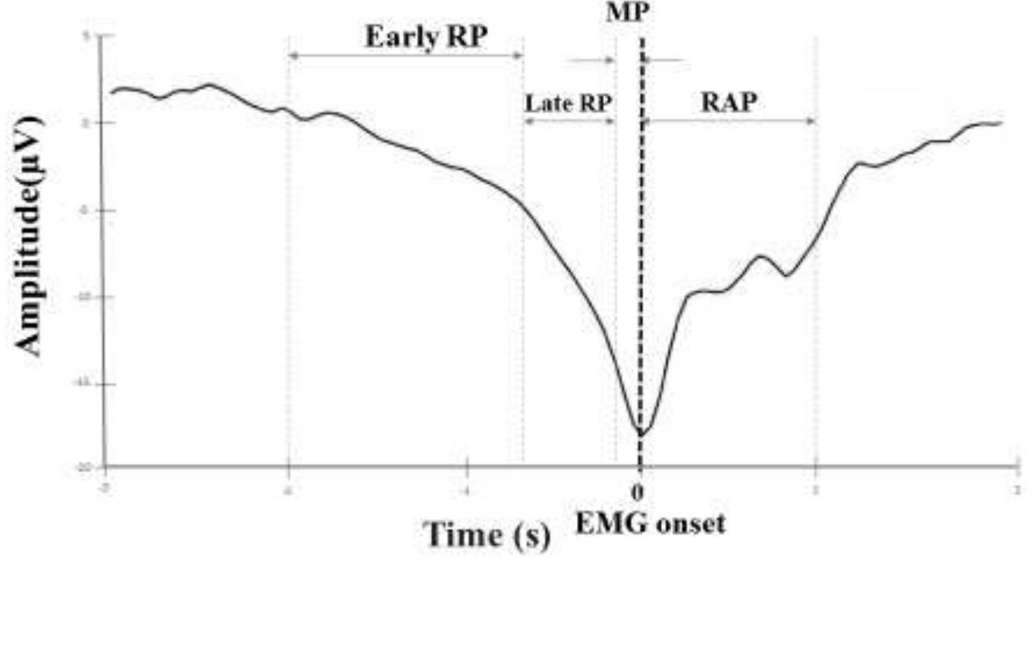 Different parts of readiness potential: early rp, late rp,
