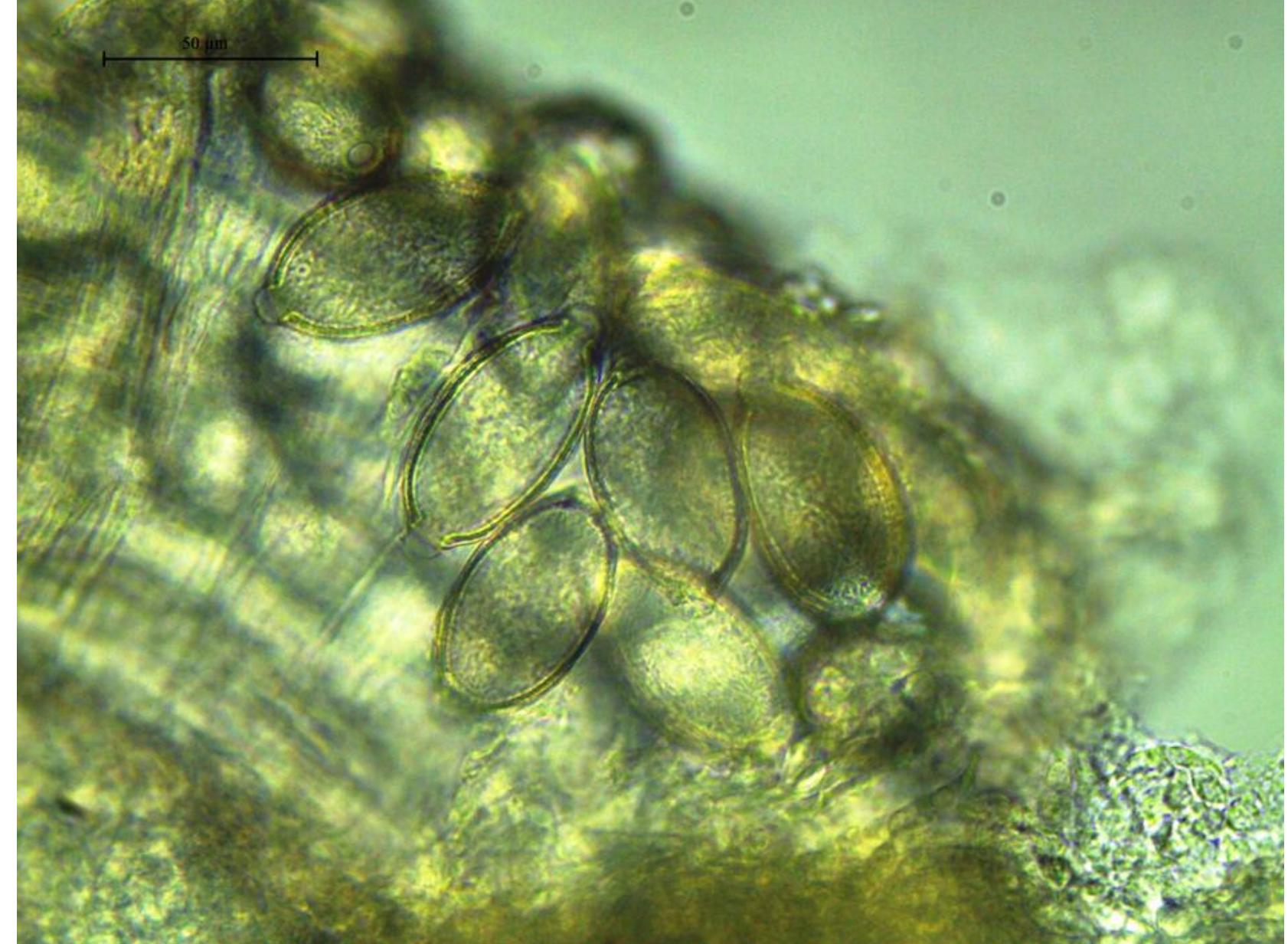 Typical trichuroid eggs in the uterus of eucoleus aerophilus