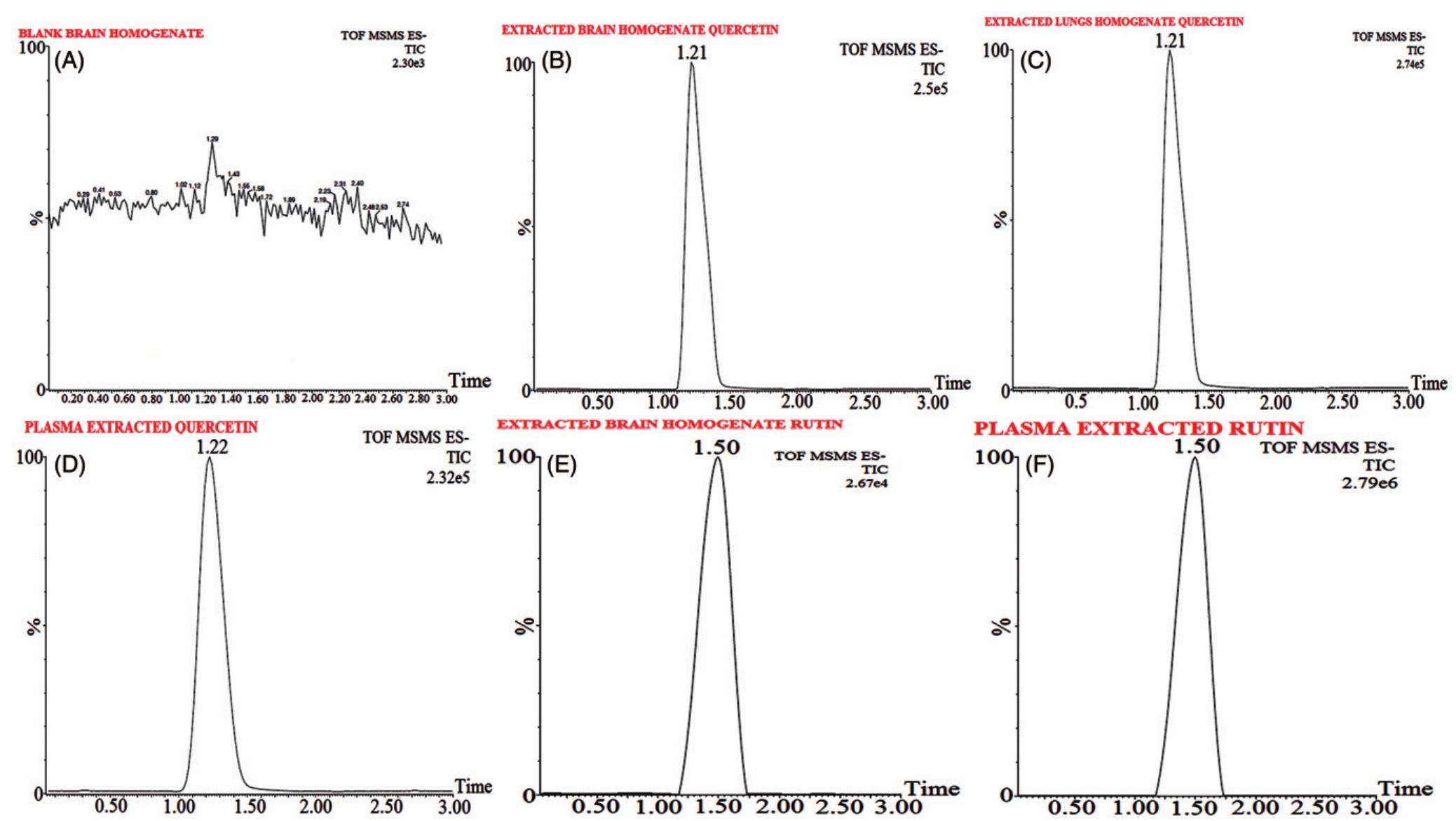 Typical chromatograms of blank brain homogenate (a),