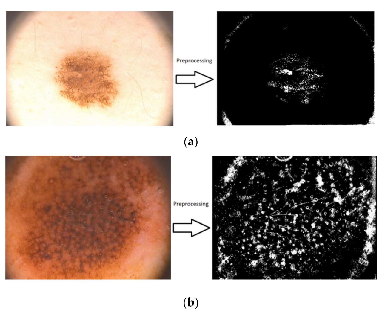 Sample images showing the results of preprocessing
