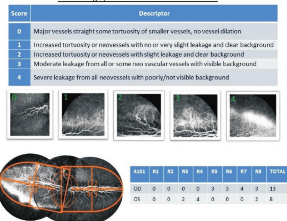 Novel grid based fa grading system for dl-aaa rabbit model