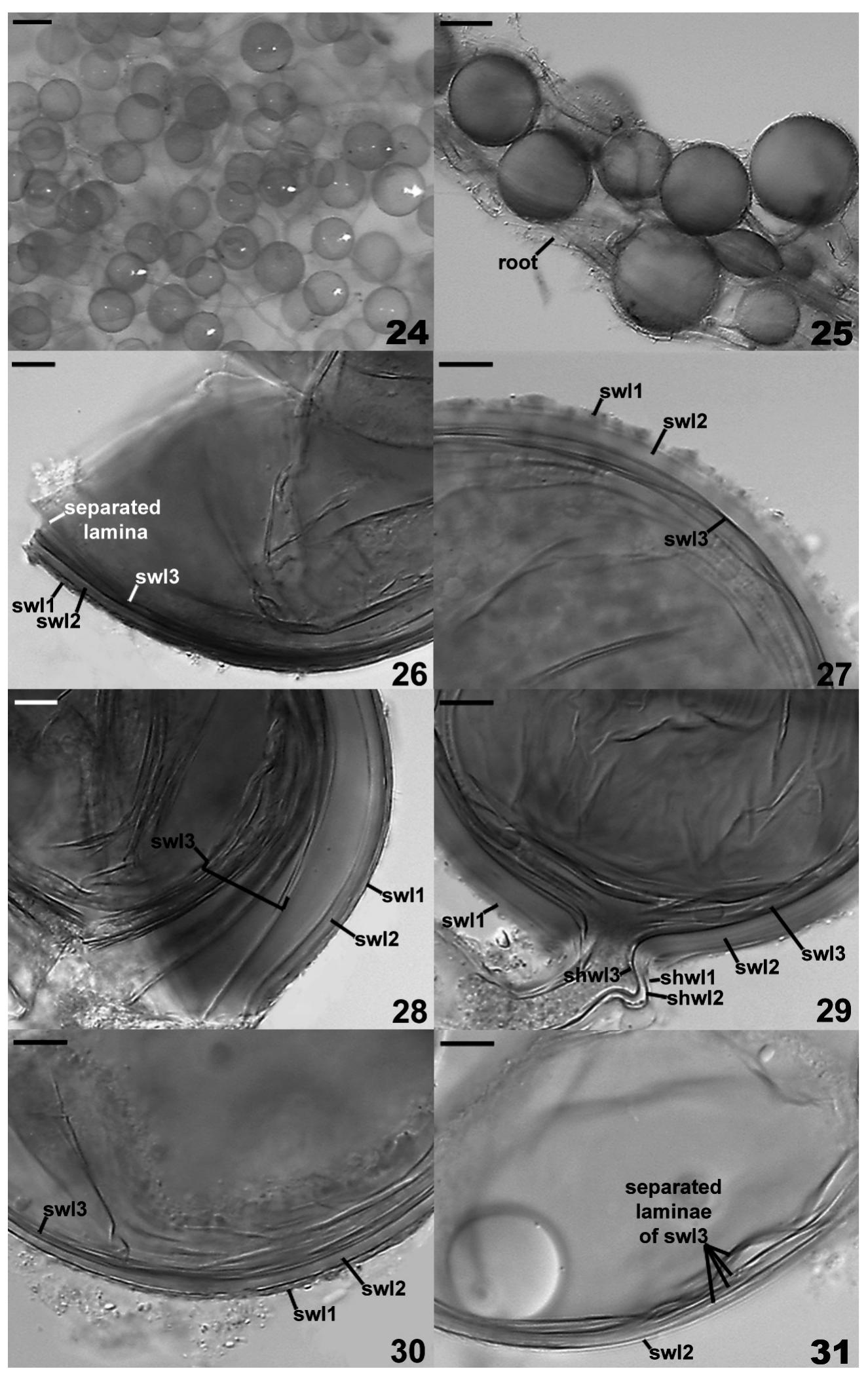 Figure 5 - Glomus irregulare, a new arbuscular mycorrhizal