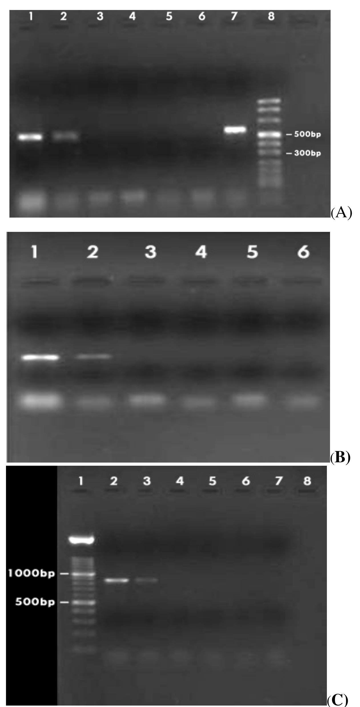 Agarose gel electrophoresis of direct colony-pcr using the